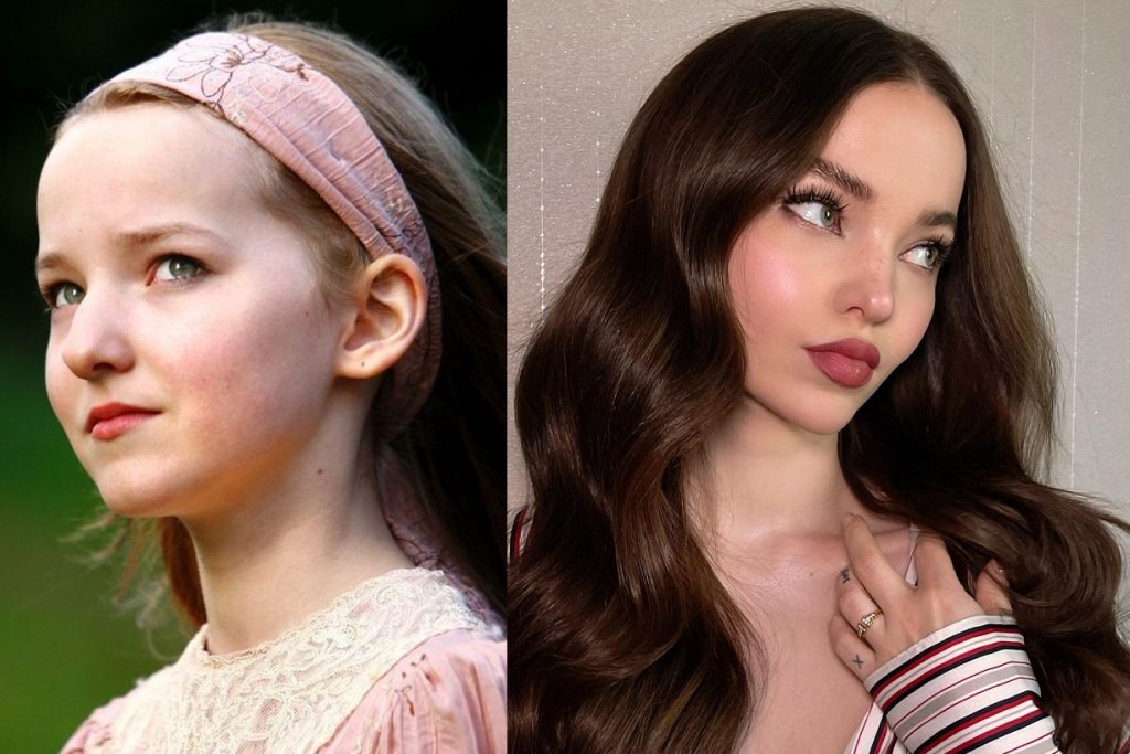 Dove Cameron's Surgery – Do You Believe The Rumors?