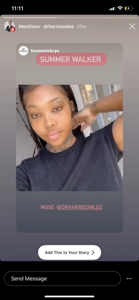 Summer Walker's Plastic Surgery – What Is The Truth Behind Rumors?