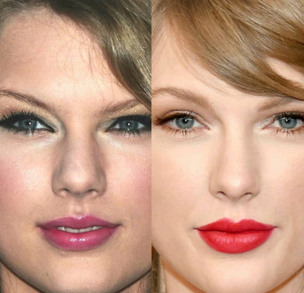 Taylor Swift's Plastic Surgery - What Has She Done?